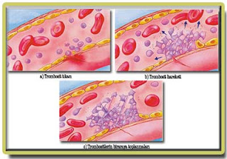 silviaquerida: Tentang TROMBOSIT