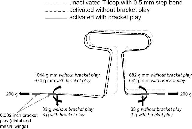 T-loop force system with and without vertical step using finite element ...