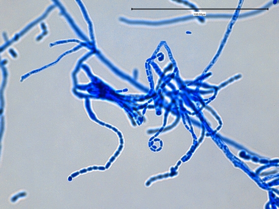 Fun With Microbiology (What's Buggin' You?): Arthrographis species