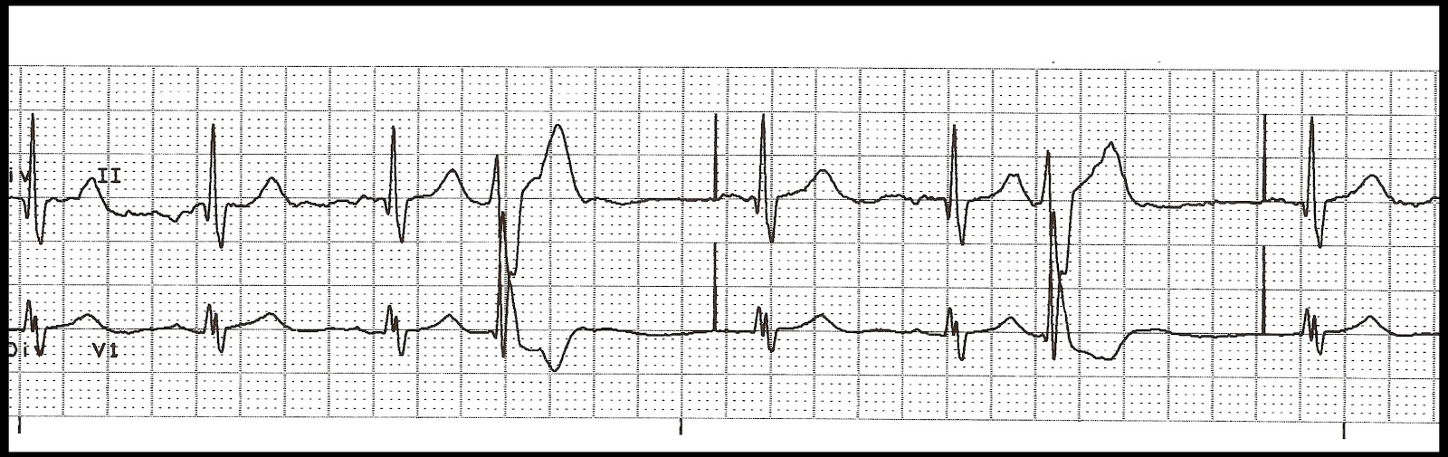 EKG Quiz 344