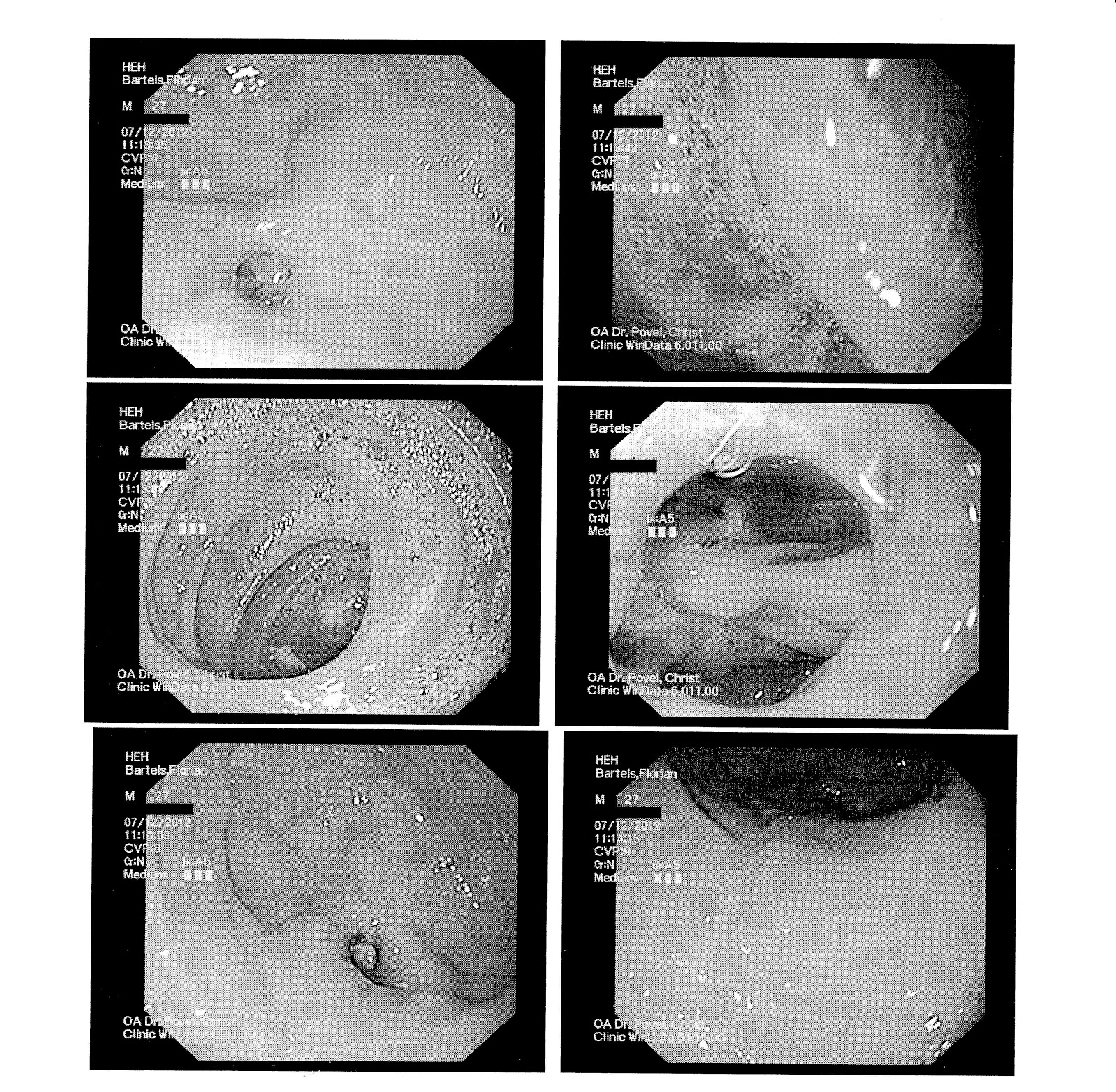 Ein neues Leben...: Das Magengeschwür ! (Teil 7)