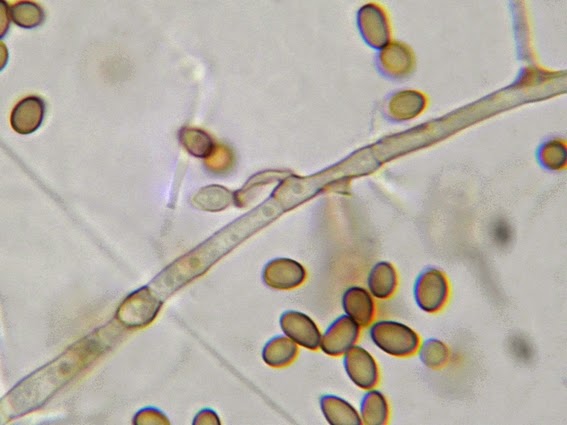 Fun With Microbiology (What's Buggin' You?): Scopulariopsis brumptii