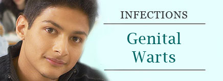 What Are the Facts About Genital Warts? ~ Doctor Globe