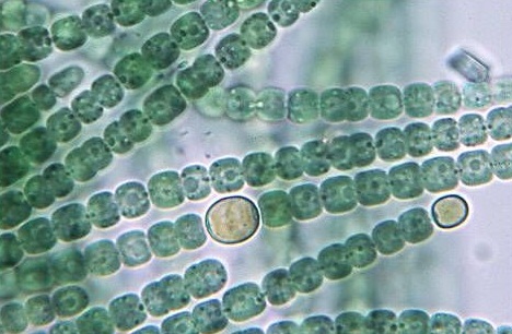 Pengertian, Morfologi, Fisiologi, Klasifikasi dan Reproduksi Alga ...