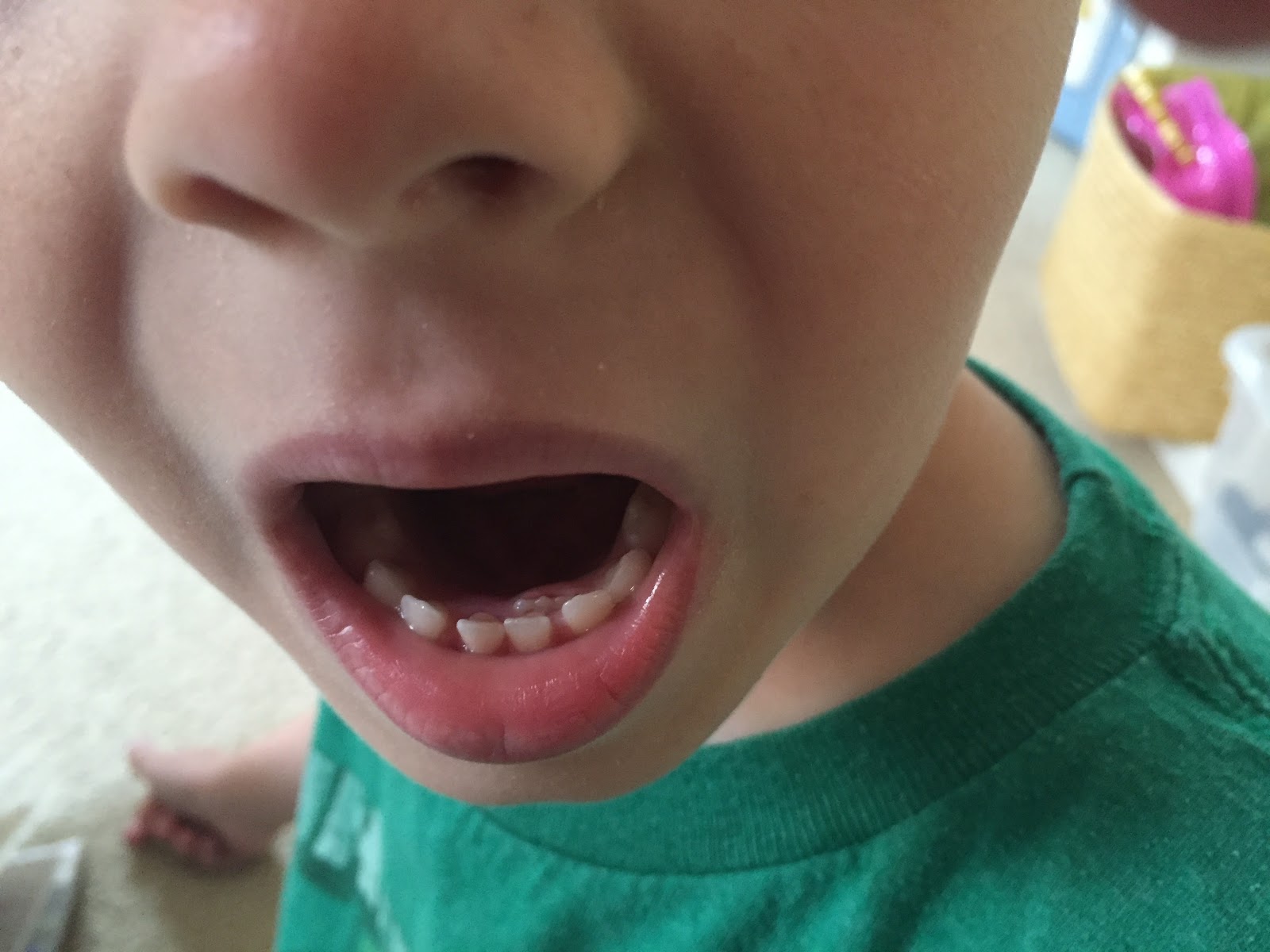 Chadwicks' Picture Place: Dalton's First Lost Tooth