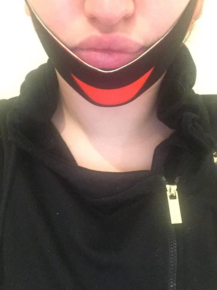 Visualising you: Chin up with ChinUp Masks