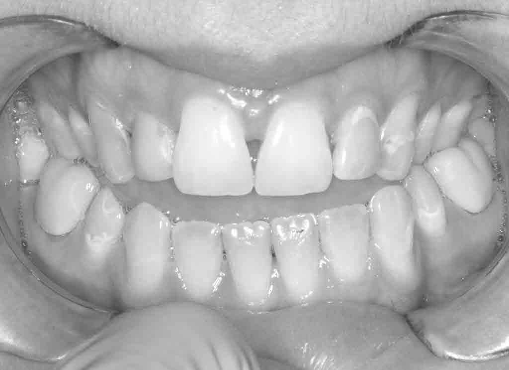 Jaw Jigsaw: Before & After Photos