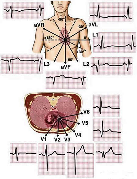 Tutomedic: RUTINA DE INTERPRETACIÓN DEL ECG:3- Eje de QRS