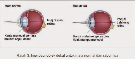 Lagenda Optometrist: PERBEZAAN RABUN DEKAT DAN RABUN TUA