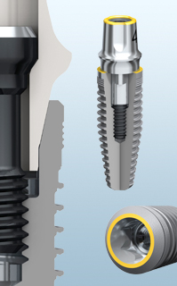 Dental Implants: NobelReplace Conical Connection & NobelReplace ...