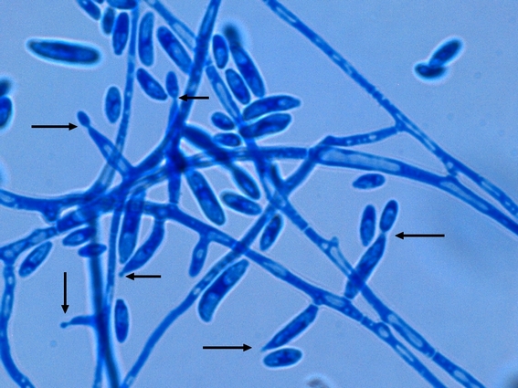 Fun With Microbiology (What's Buggin' You?): Fusarium oxysporum