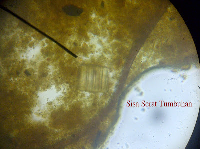 Rizqi Murtafi'ah: Pemeriksaan Feses Lengkap