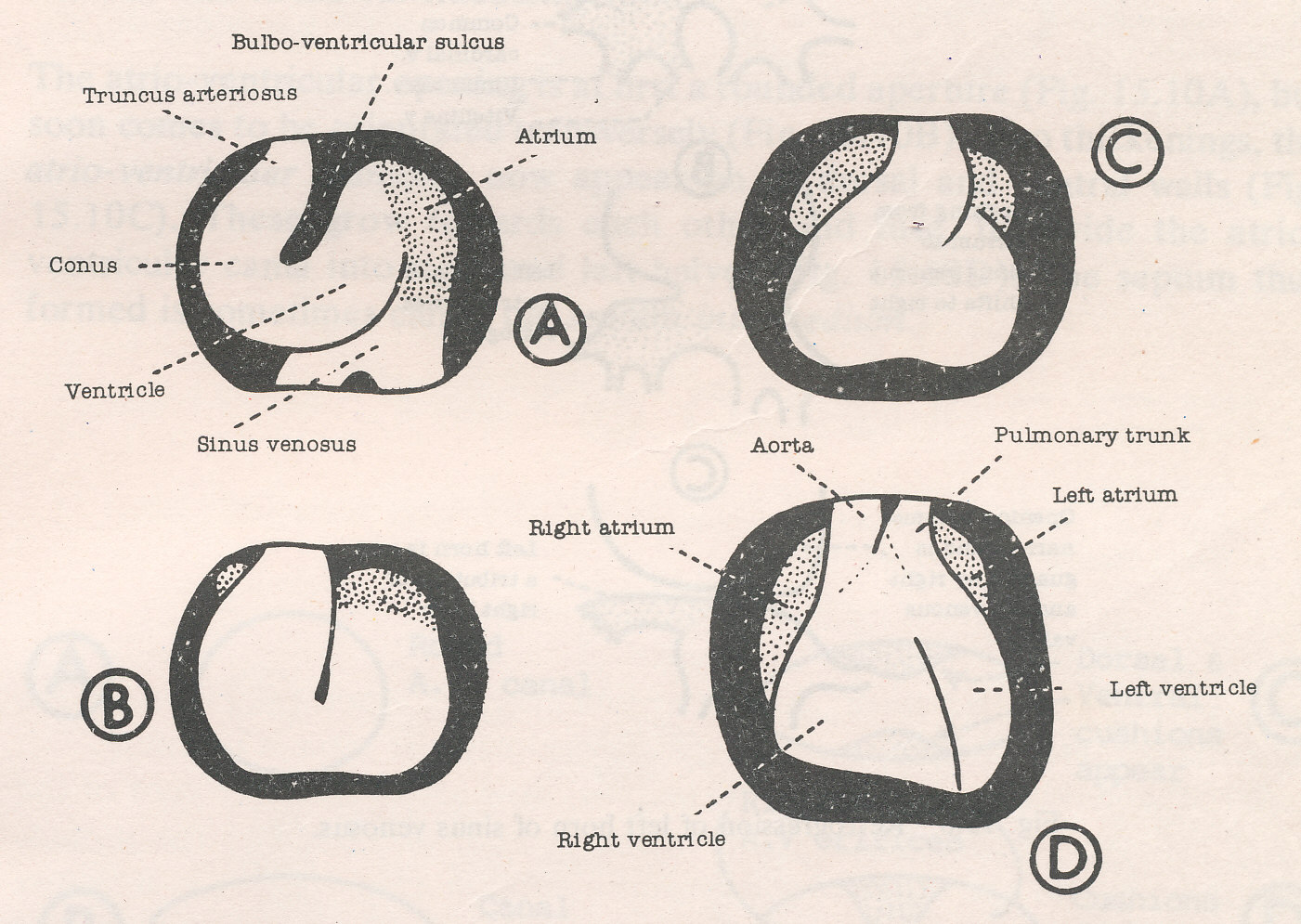 Pedi cardiology: Development: Heart Tube & Looping