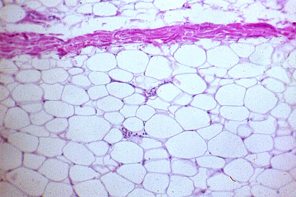 MEDmac: TRABAJOS DE HISTOLOGIA