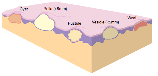 Examining The Skin and Describing Lesions | Dermatology Information ...