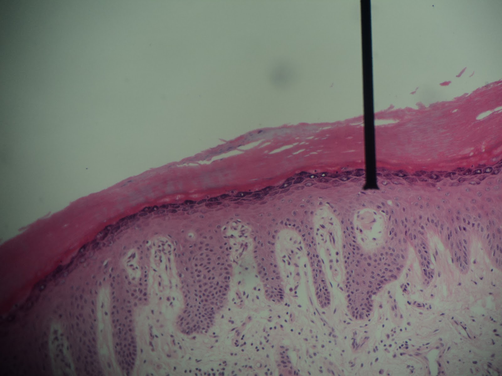 MEDICINA USMP: FOTOS DE HISTOLOGIA II - PULPEJO DE DEDO