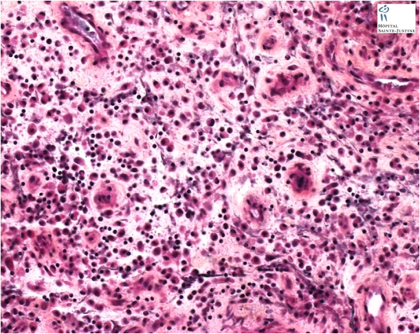 Dentistry and Medicine: Regeneration healing (repair)-General Pathology ...