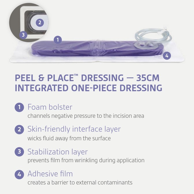 傷口大師: 2016年，進化版的術後傷口負壓系統Prevena plus