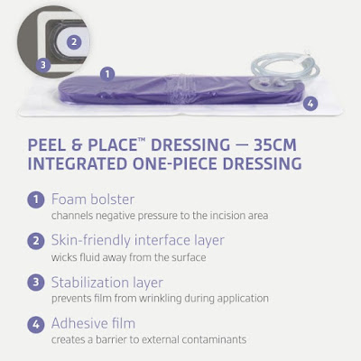 傷口大師: 2016年，進化版的術後傷口負壓系統Prevena plus