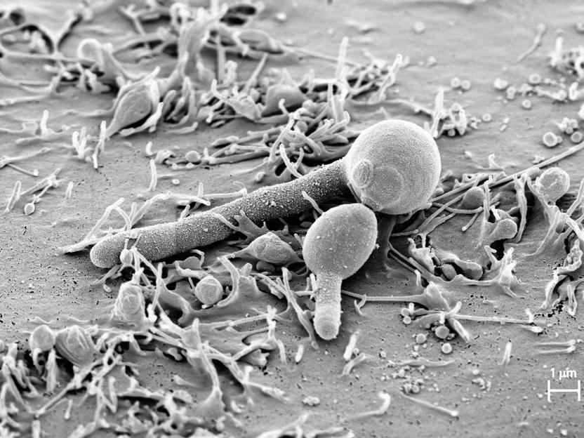 Candida Albicans Mantarı için Bitkisel ve Doğal Tedavi Yöntemleri