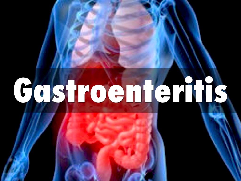 Tips Mencegah Gastroenteritis