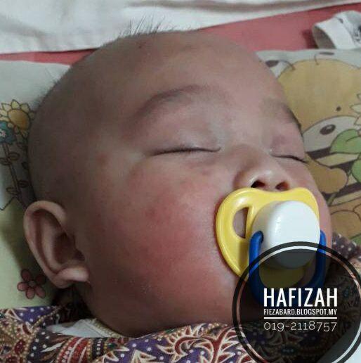 fiezaBard: 8 Petua Mudah Kurangkan Ruam dan Kemerahan Kulit Bayi Yang ...