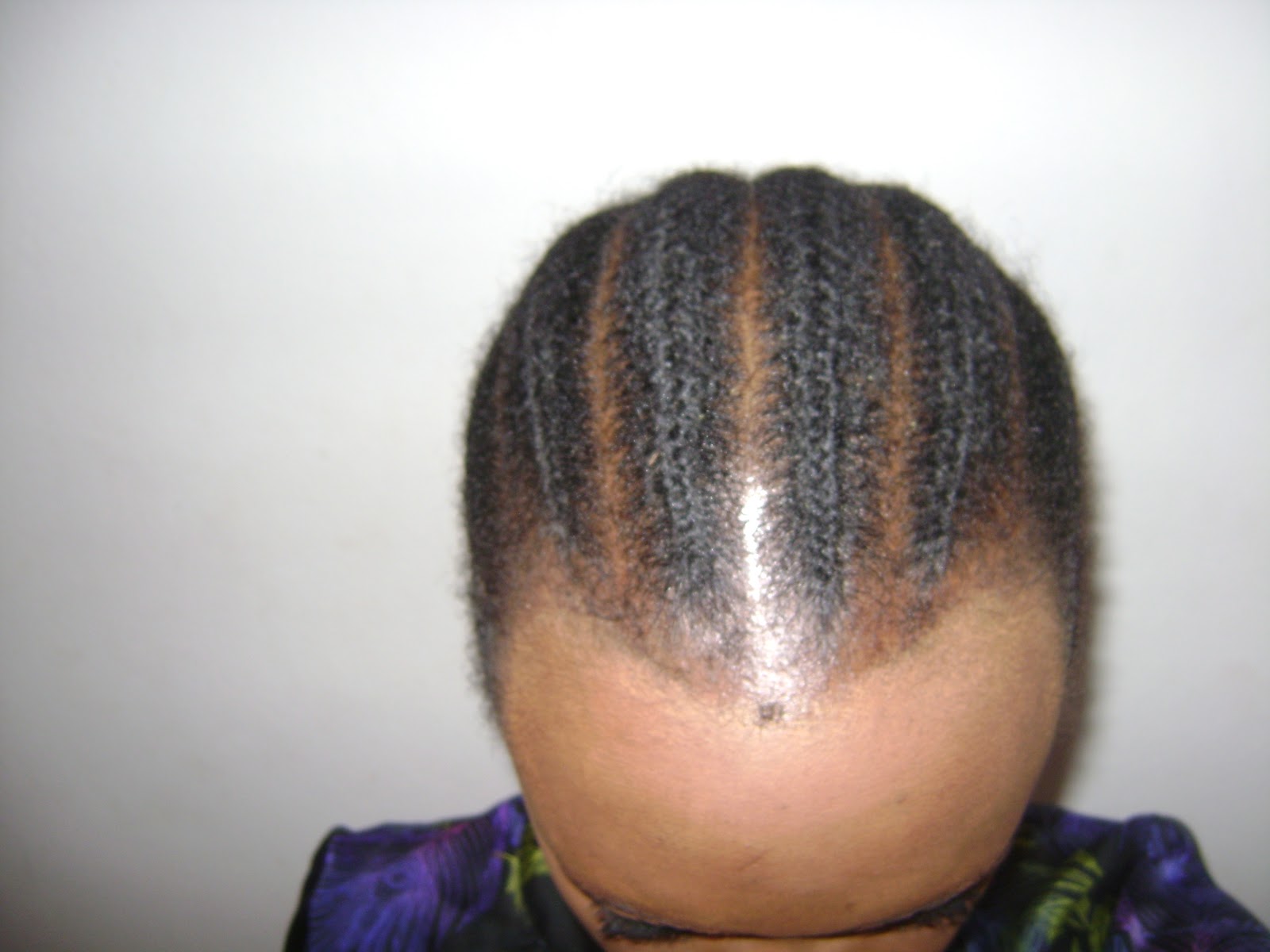 Diva's Hair-Story: Dry Shafts, Thirsty Follicles...My Story