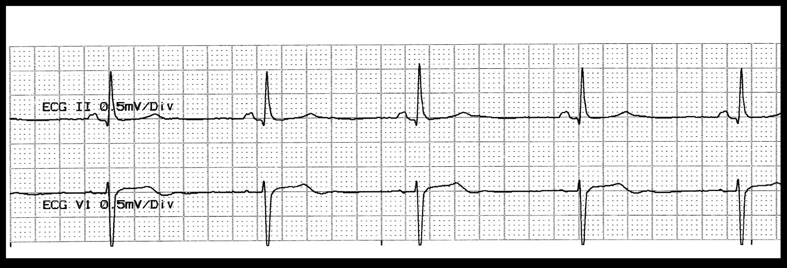 Basic EKG Rhythm Test 34