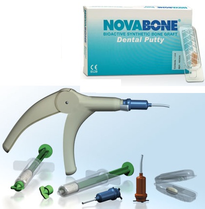 Periodontia e Implantes: NovaBone - substituto ósseo para preenchimento