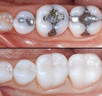 Nuestros Servicios | Clínica Dental Clidente