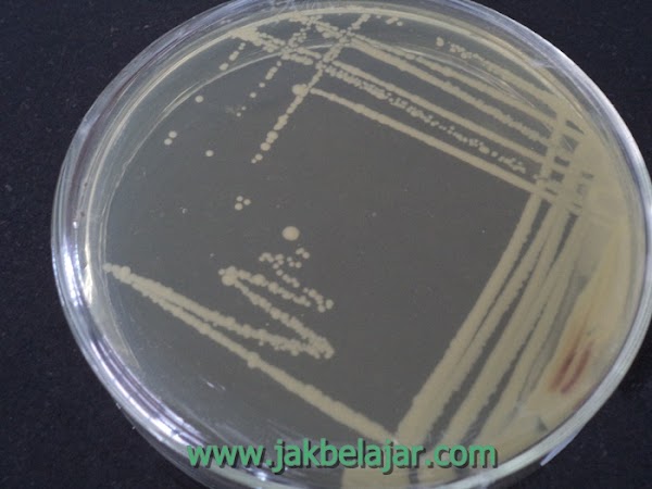 Mengenal Metode Streak Plate dalam Isolasi Bakteri - Jak Belajar