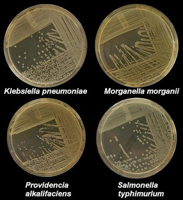 Media Nutrient Agar ~ Medical Laboratory Technologist