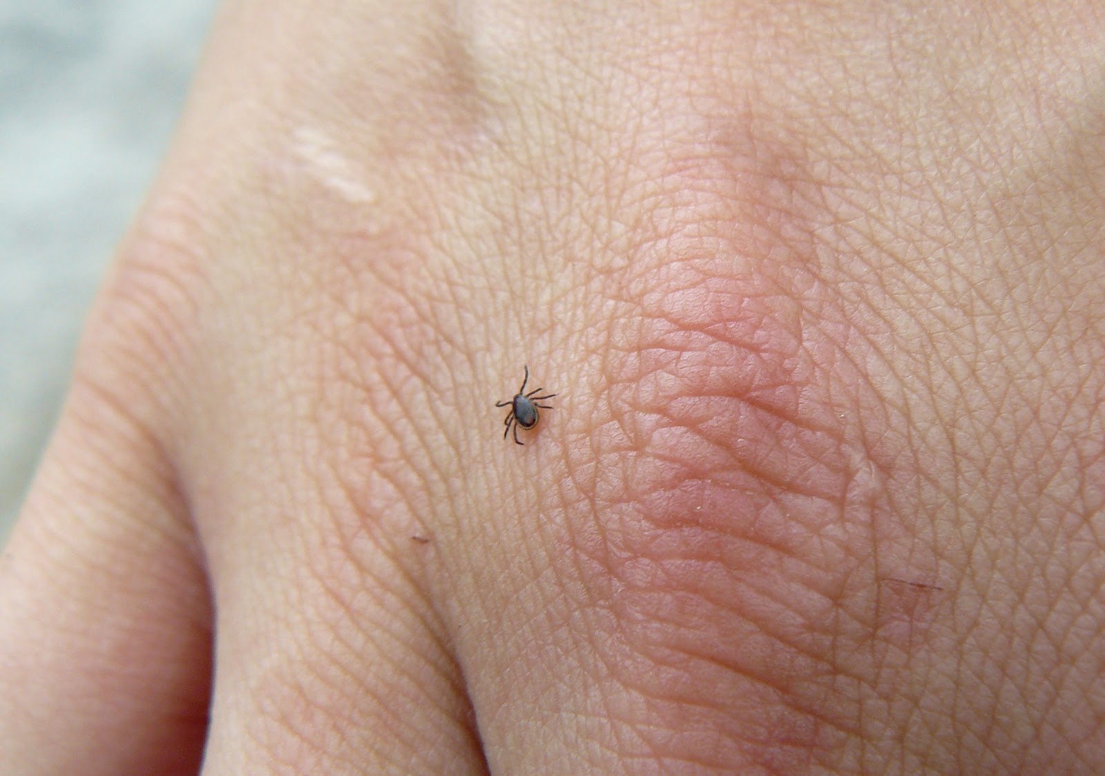Ash Out of Doors: Blacklegged Ticks in Ottawa!