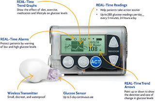 Low Blood Sugar Symptoms: Insulin Pump Supplies, Make Life Easier for ...