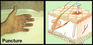 First-Aid Kid: Wound Managment Part 1