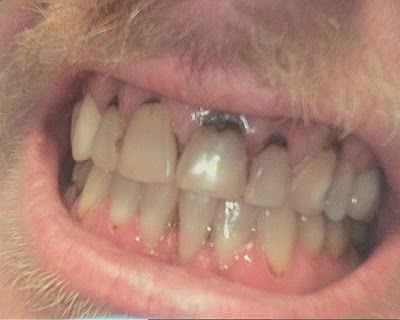 DrChetDMD: Rampant Decay Before and After