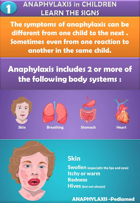 PEDIAMED: ANAFILAXIA