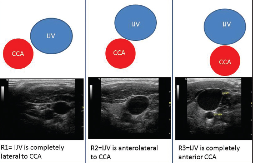 Medicine by Sfakianakis G. Alexandros: Altered anatomical relationship ...