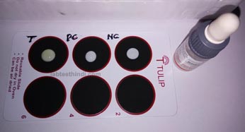 RA Test - latex agglutination slide test ~ Lab Test Hindi