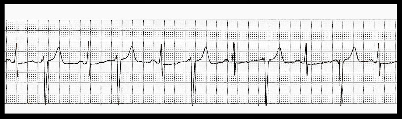 EKG Rhythm Quiz 270