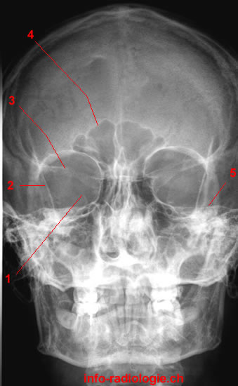 Fisioterapia: Radiografias (Para nós ajudar em Fisiopatologia Clinica ...