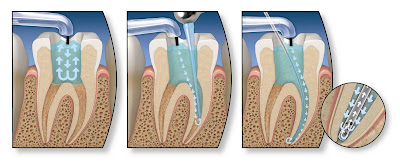 Endodontic: Endodontics: Part 2 Diagnosis and treatment planning