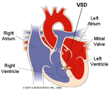 Joey's Heart Journey: Joey's Diagnoses
