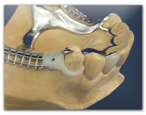 Bowland Dental Lab: Dentures