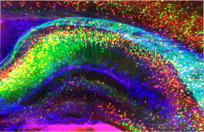 CLARITY - Amazing brain imaging