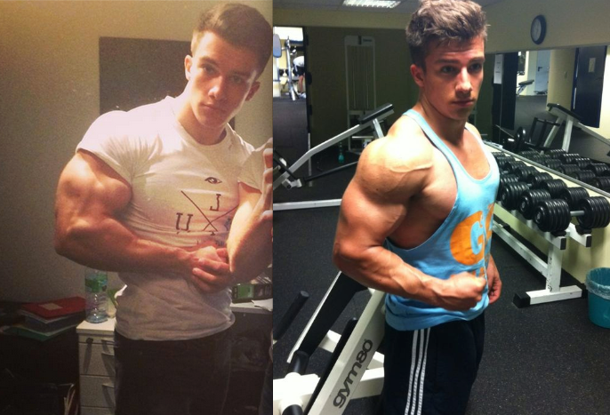 Daily Bodybuilding Motivation: Tim Gabel - Teen Bodybuilder