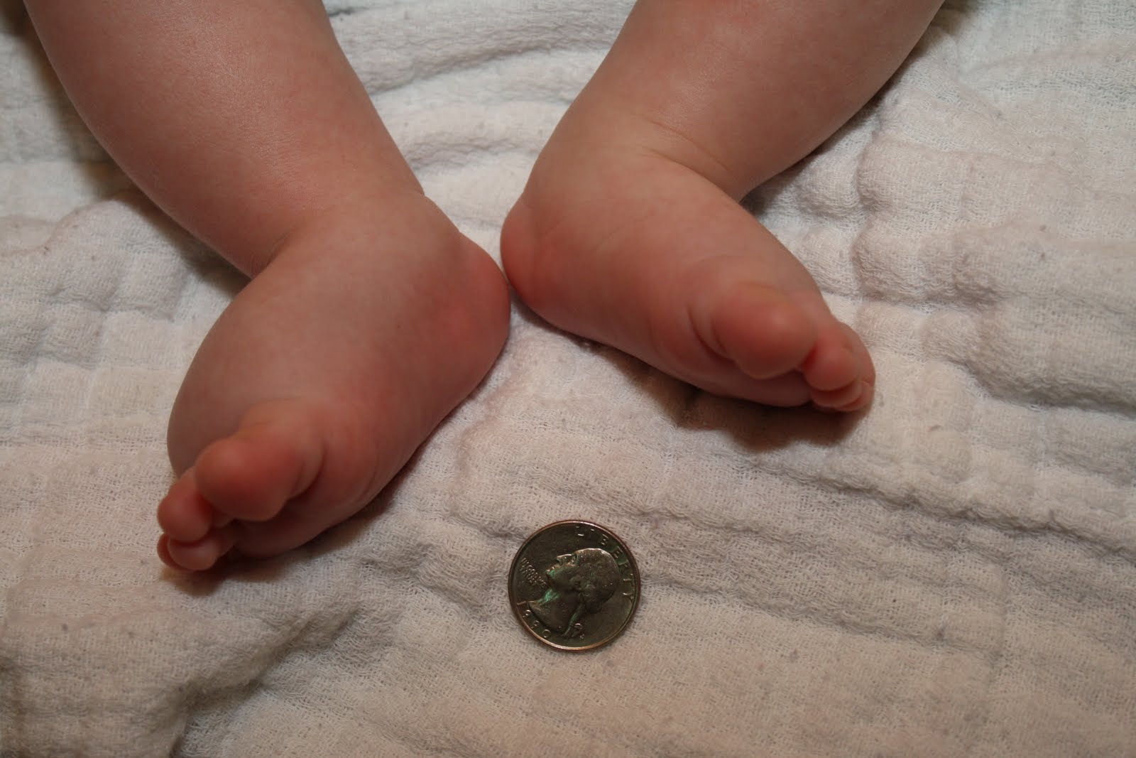 On Pine Hill: Puffy foot: MRI at Children's