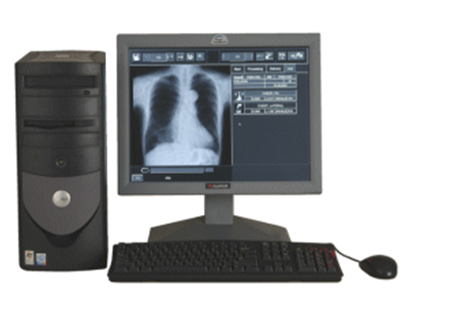 radiologi oh radiologi: CR