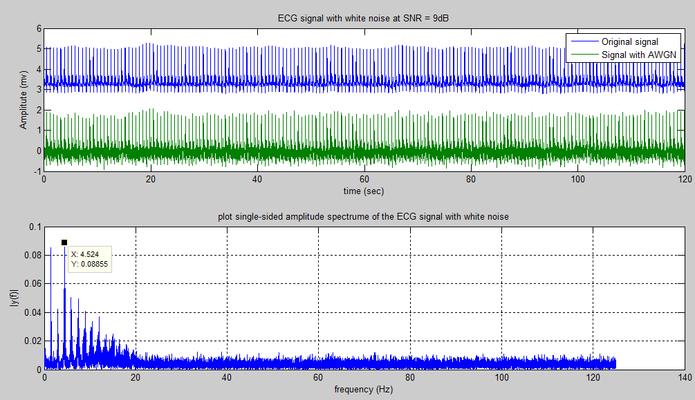 Biomedical Signal And Image Processing Projects Using Matlab And Labview Tools Matlab Code To