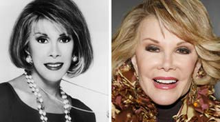 Joan Rivers Plastic Surgery Before and After Botox and Cheek ...
